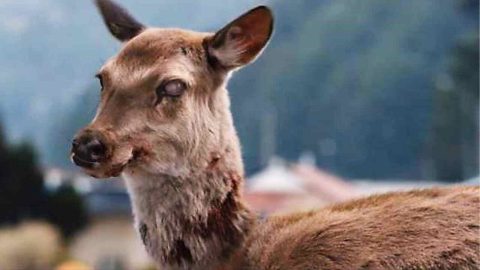 Brain Drain: "Zombie Deer" Disease Spreads, Raising Fears of Human Leap